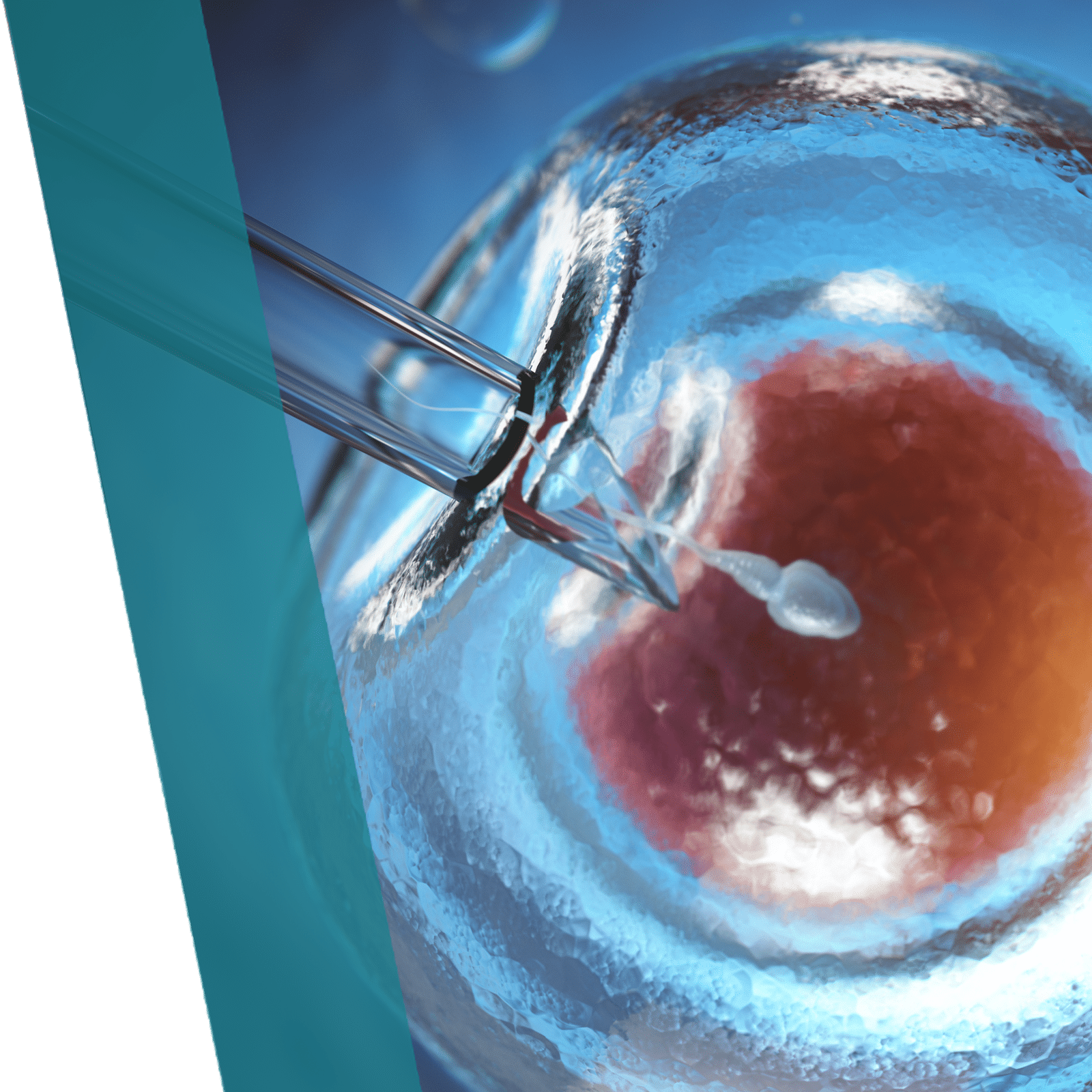 Εξωσωματική Γονιμοποίηση (IVF) - Dr Fotopoulos